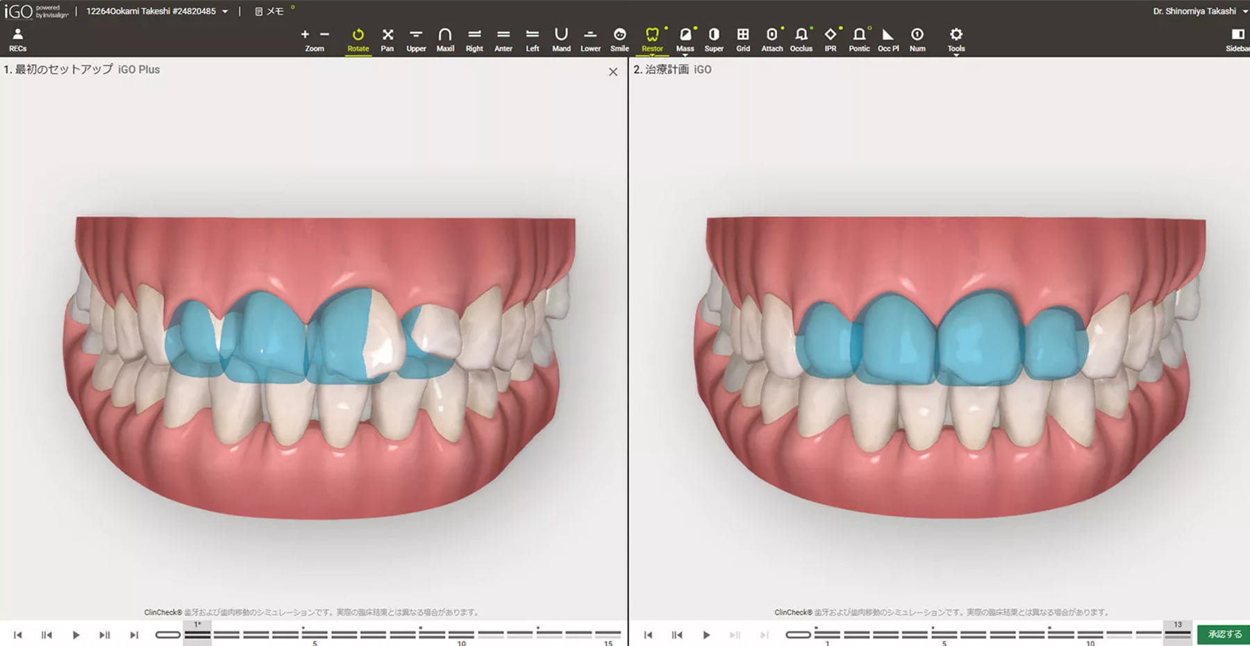 大人の矯正歯科治療 | CareCure総合歯科松戸｜松戸駅東口から徒歩1分の歯医者さん
