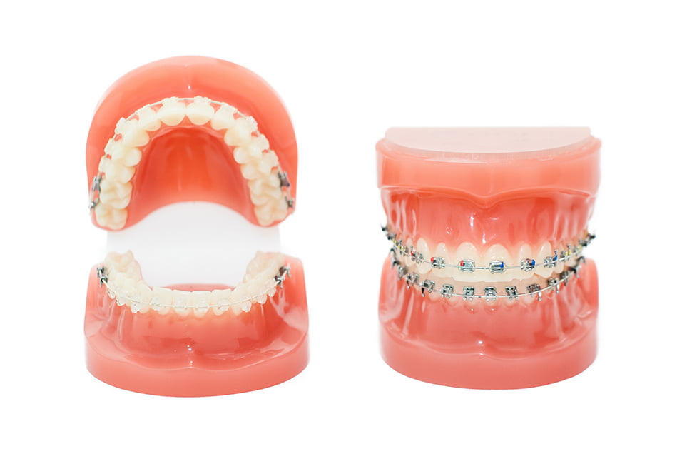 大人の矯正歯科治療 | CareCure総合歯科松戸｜松戸駅東口から徒歩1分の歯医者さん